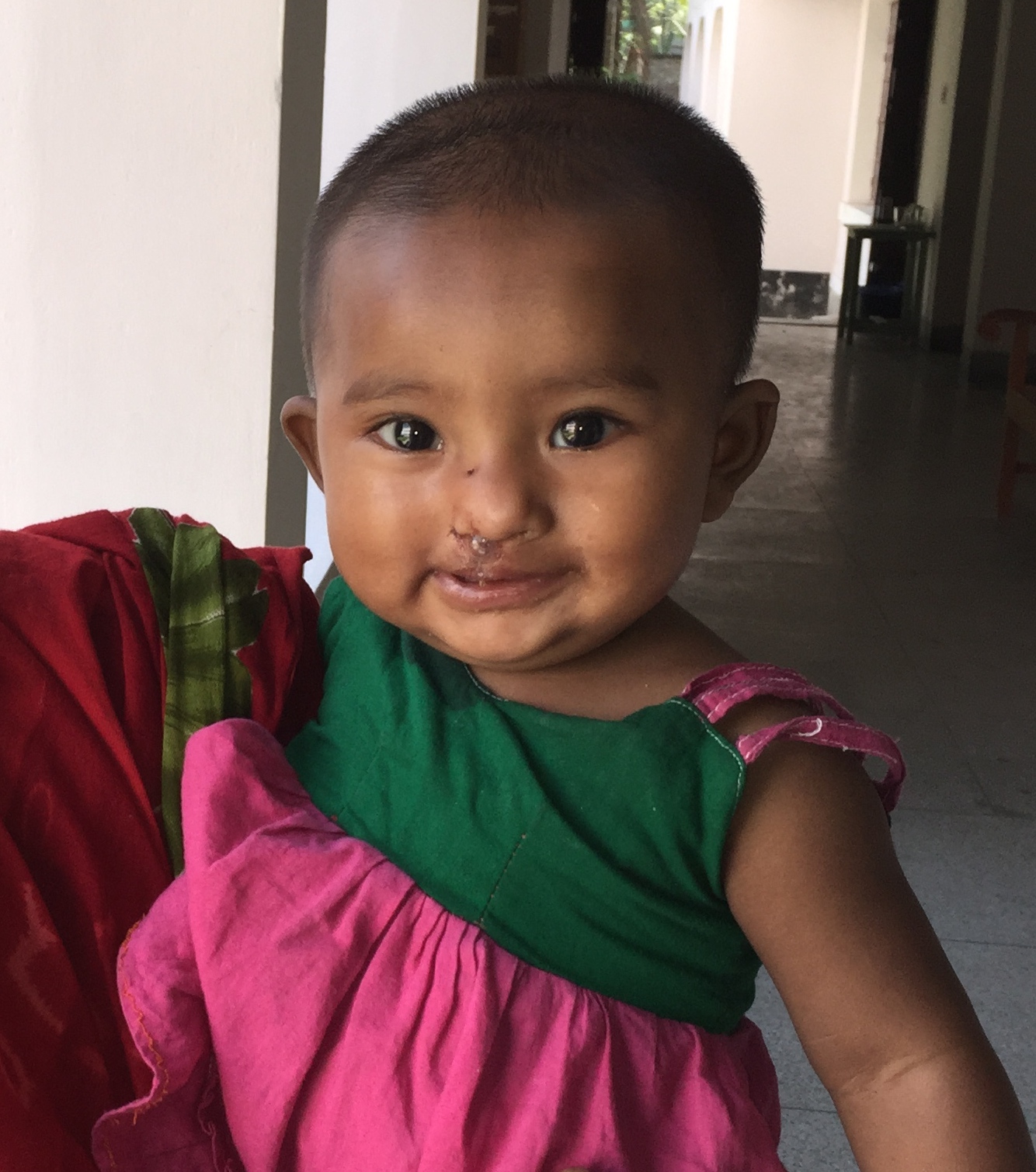 Face Value: RSDM Team Repairs Cleft Palates in Bangladesh | Rutgers ...
